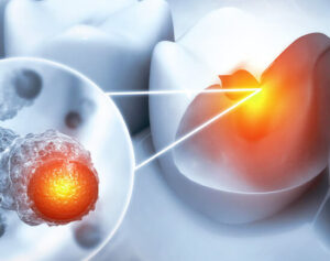 Laser Bacterial Reduction in Irving, TX | Dental Artistry Irving